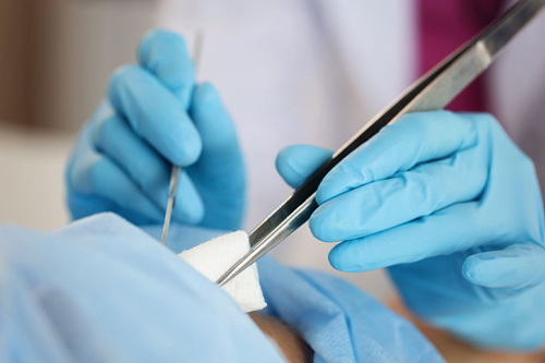 Medical Procedure | Natchitoches Parish Journal